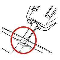 1. Subcutaneous Engineered Stabilisation Device Introduction – HC21 Academy